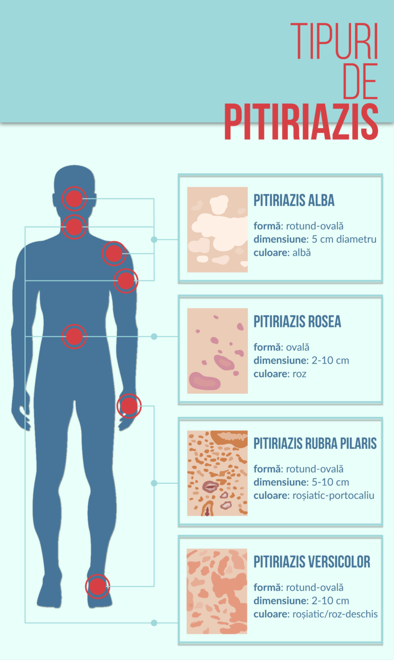 Psoriazis și Pitiriazis – care e diferența, cum se recunosc, cauze ...