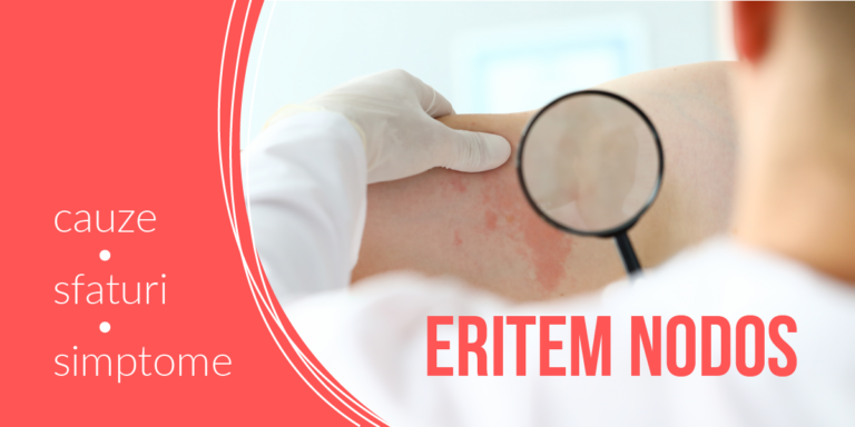Eritem nodos - Medic Chat