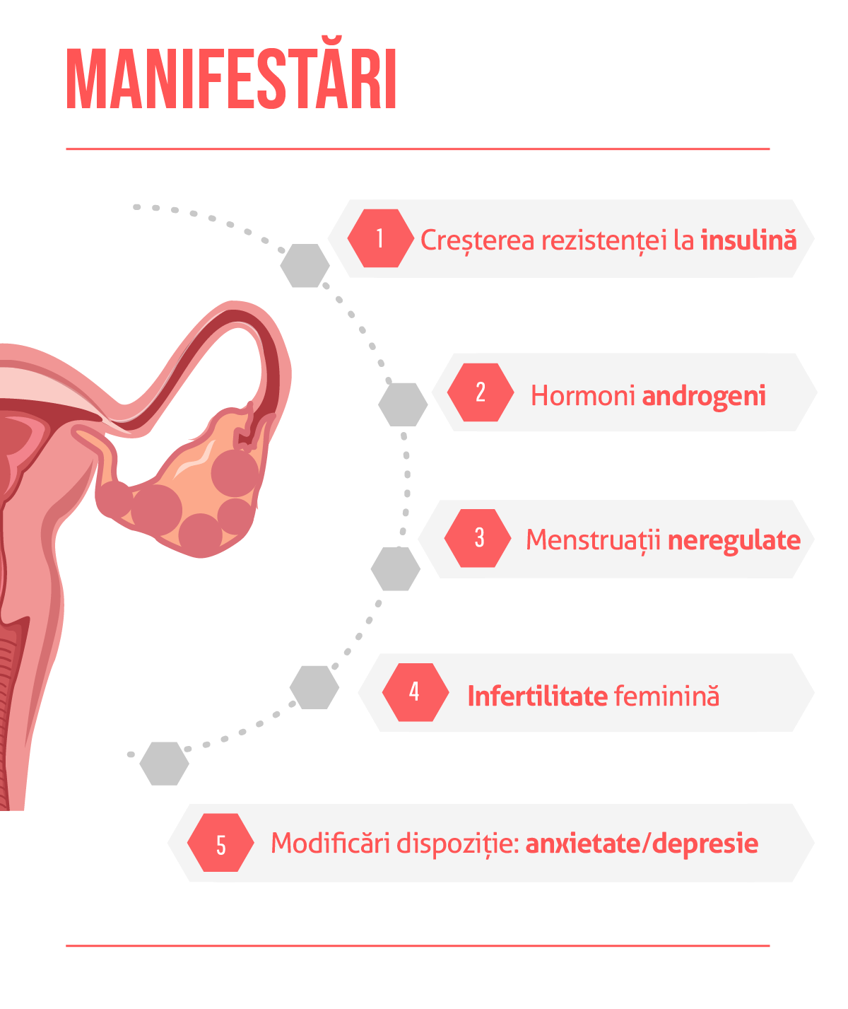 Sindromul ovarelor polichistice (SOP): Cauze, Simptome și tratament