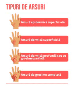 Arsuri. Arsura de gradul I, II și III. Simptome, Complicații și ...