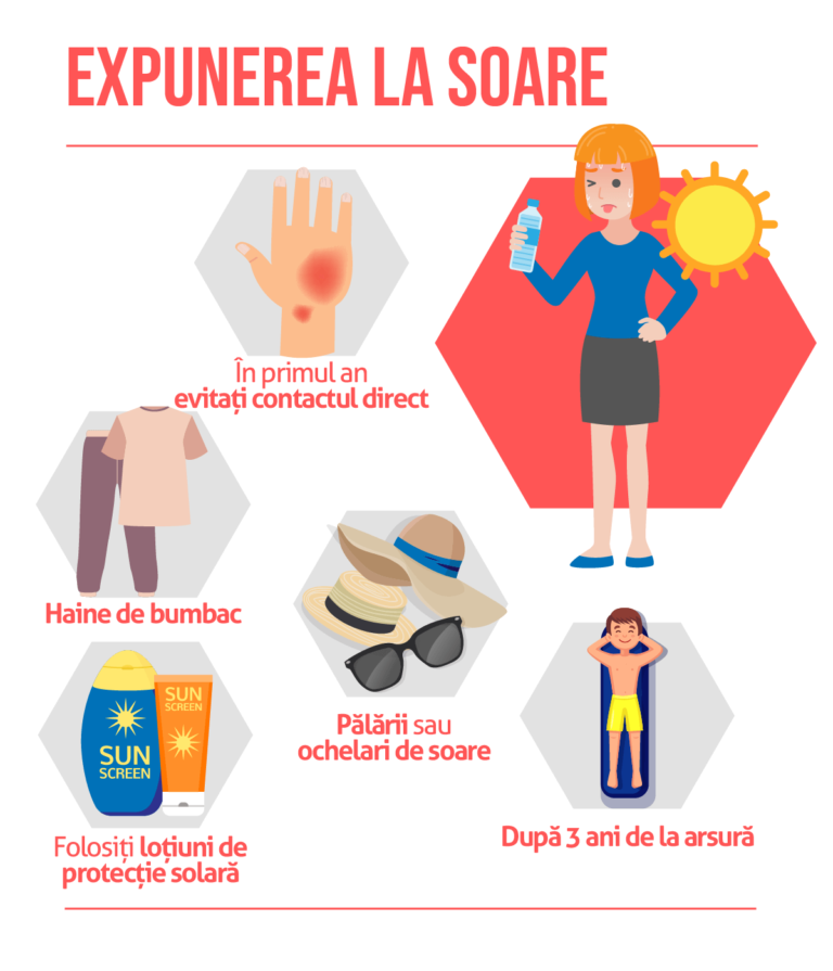 Arsuri. Arsura de gradul I, II și III. Simptome, Complicații și ...