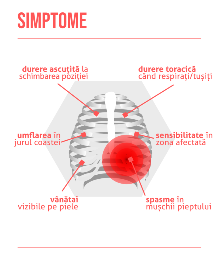 Coaste fisurate sau rupte. Fracturi la nivelul coastelor. Cauze ...
