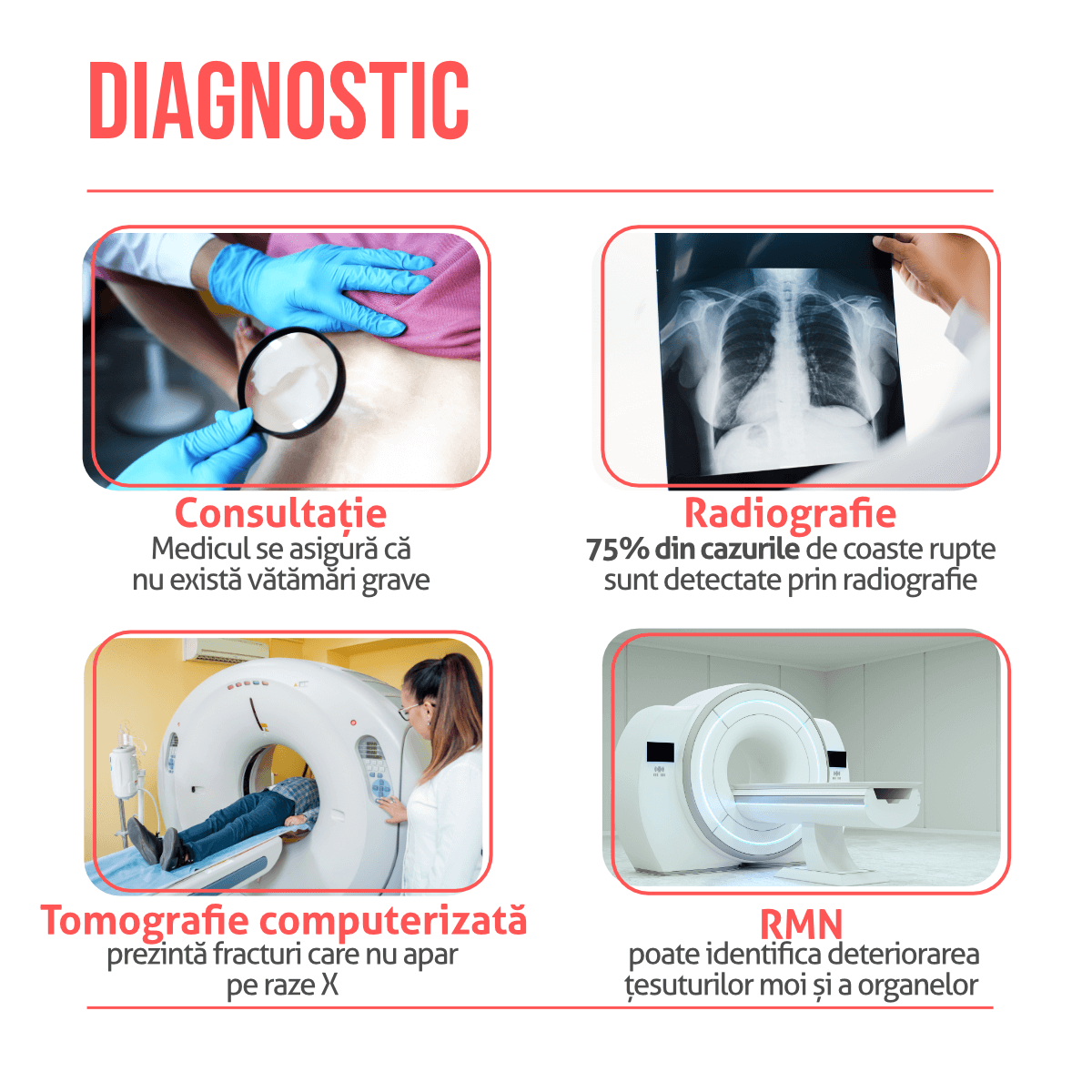 Coaste fisurate sau rupte. Fracturi la nivelul coastelor. Cauze ...