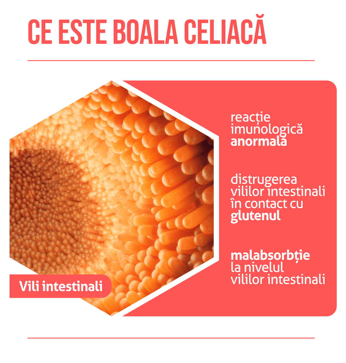 Boala celiacă - intoleranța la gluten - Medic Chat