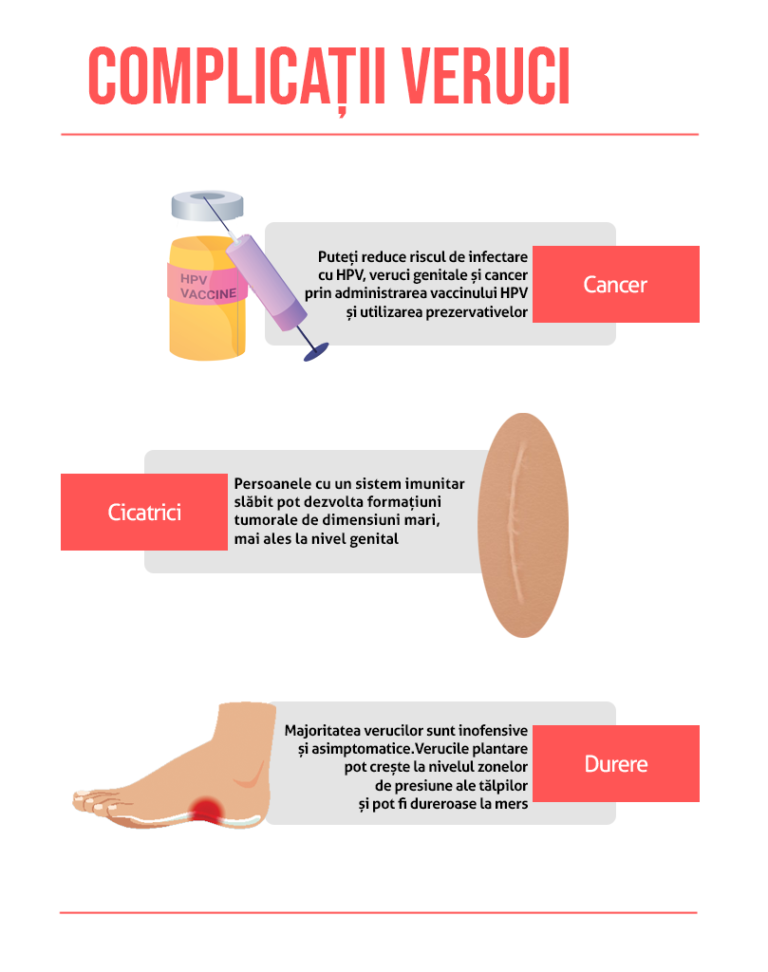 Verucile - papiloame și negi - Medic Chat