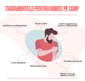 De Ce Apar Bubițe pe Corp? Cauze, Simptome, Diagnostic și Tratament ...