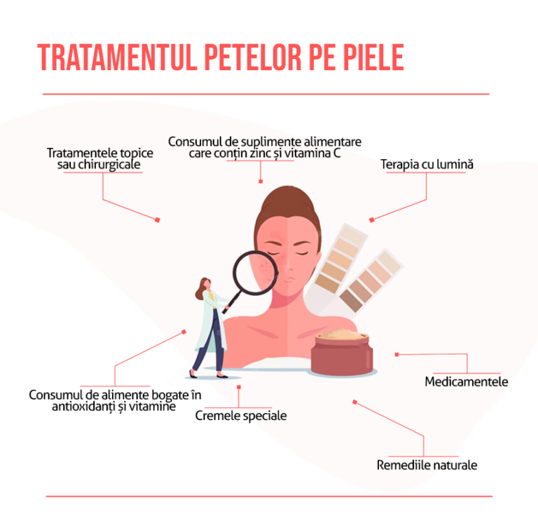 Pete pe Corp: Albe, Roșii sau Maronii. Cauze și Tratament - Medic Chat